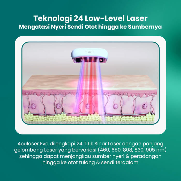 ACULASER EVO – Alat Terapi Laser Portable Bantu Meredakan Nyeri Otot ...